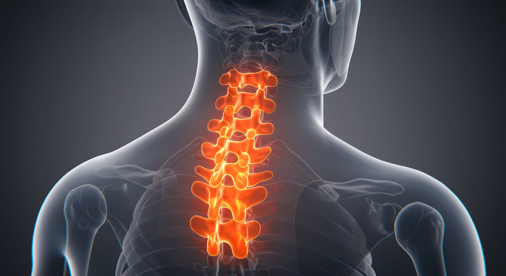 What to Expect After Cervical Spine Surgery - NeuroSpine Plus